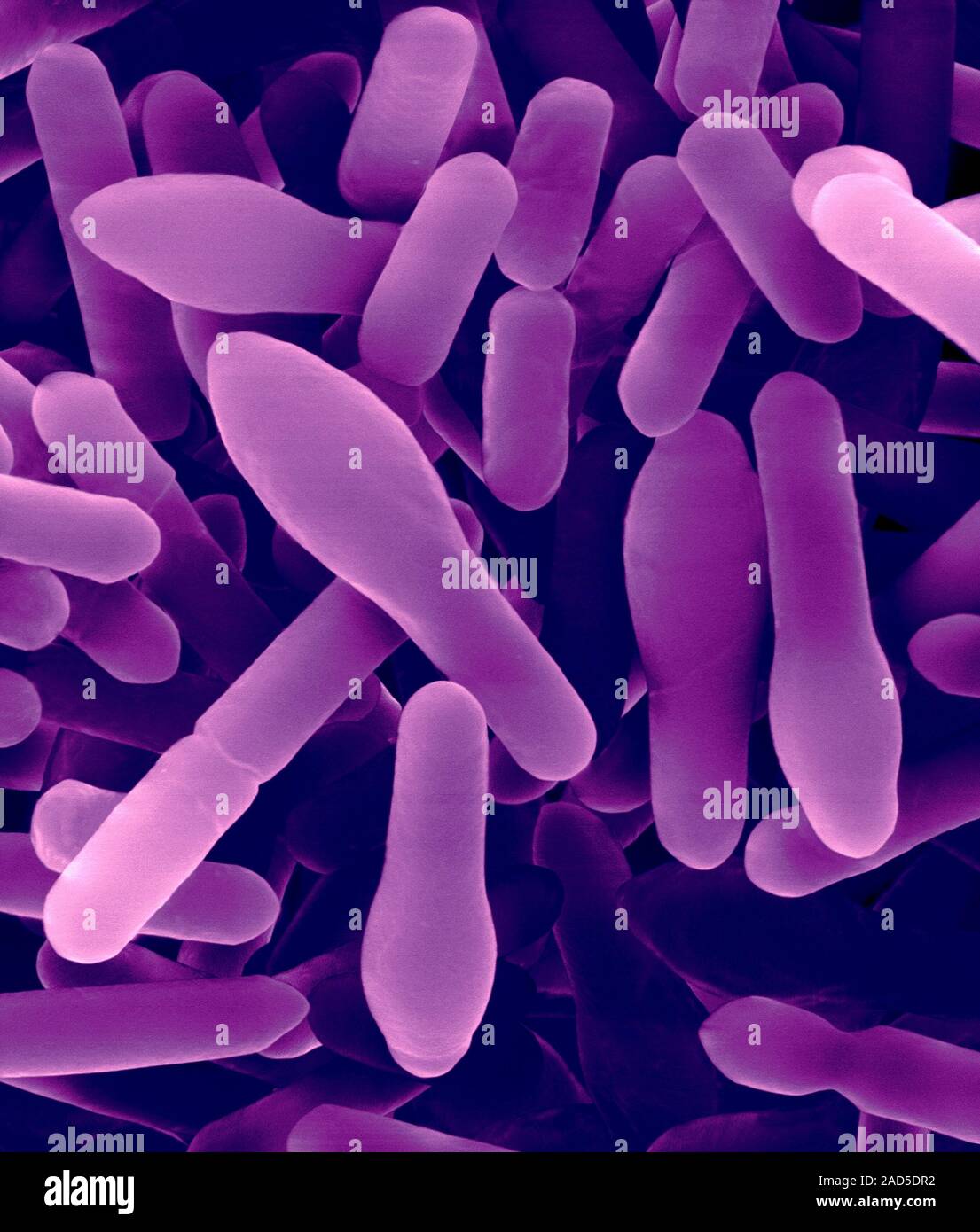 Coloured scanning electron micrograph (SEM) of Clostridium sporogenes ...