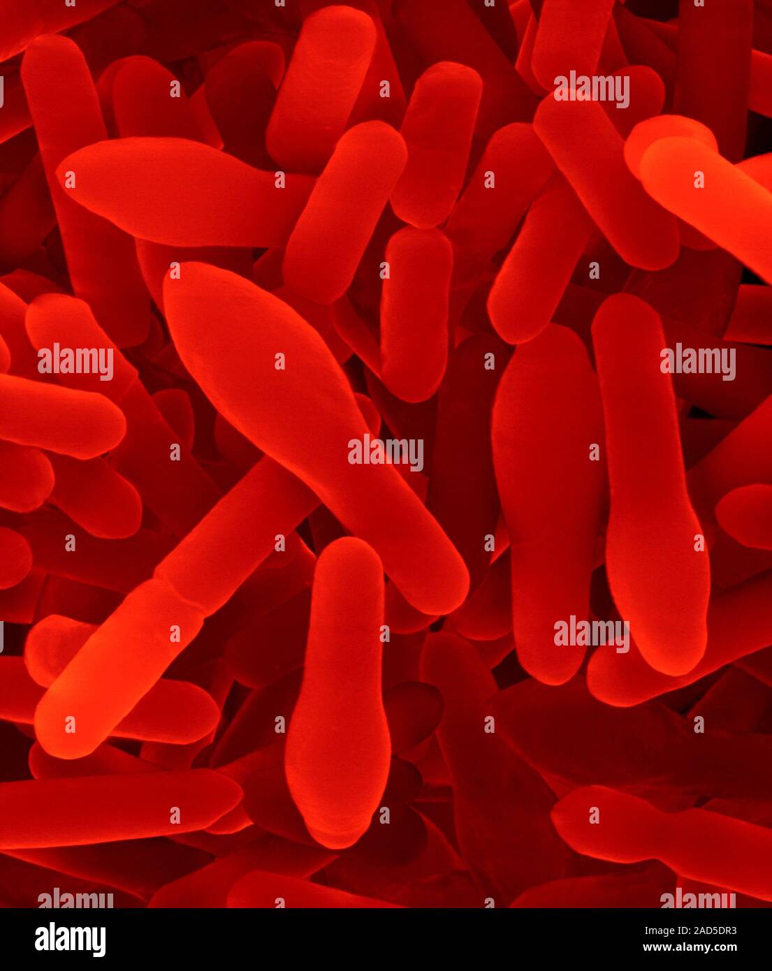 Coloured scanning electron micrograph (SEM) of Clostridium sporogenes ...