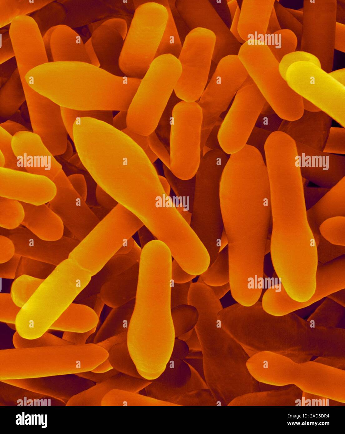 Coloured scanning electron micrograph (SEM) of Clostridium sporogenes ...