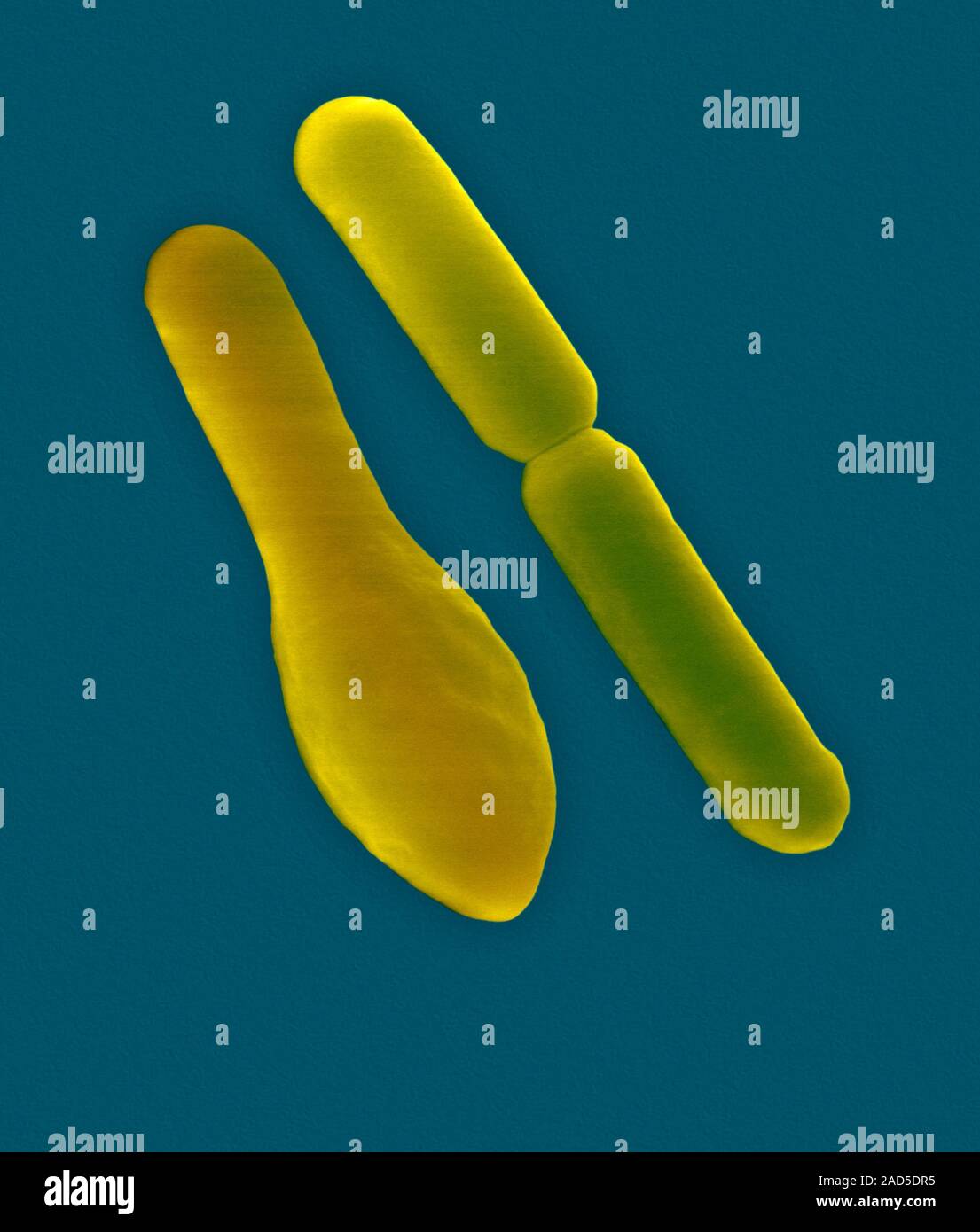 Coloured scanning electron micrograph (SEM) of Clostridium sporogenes ...