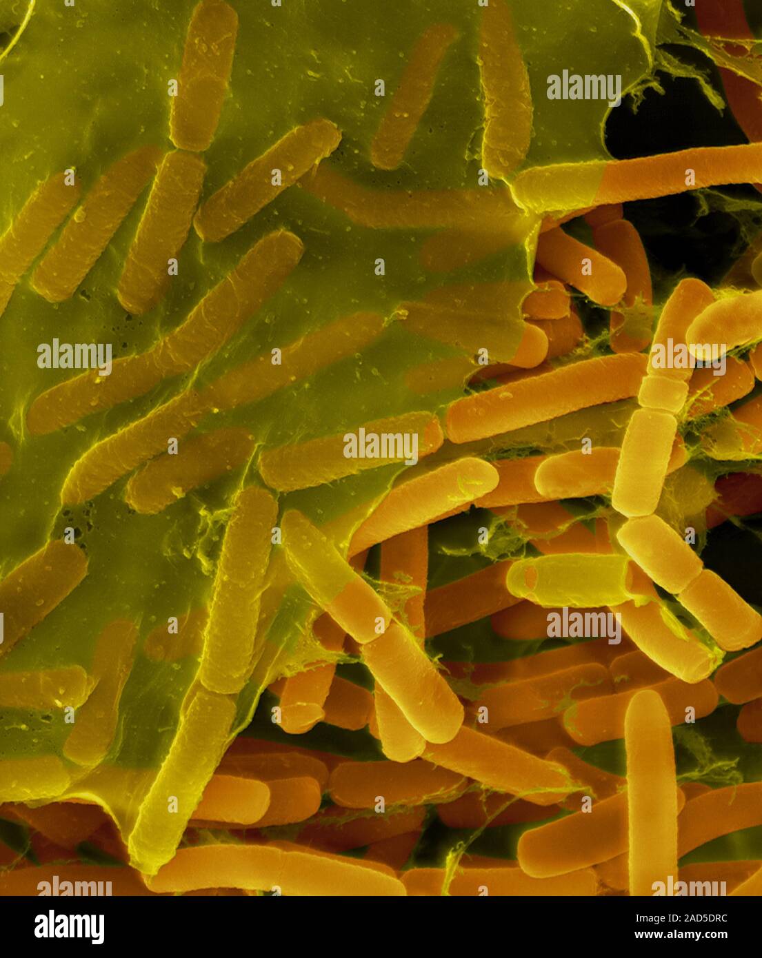 Coloured scanning electron micrograph (SEM) of Bacillus sp. forming a ...