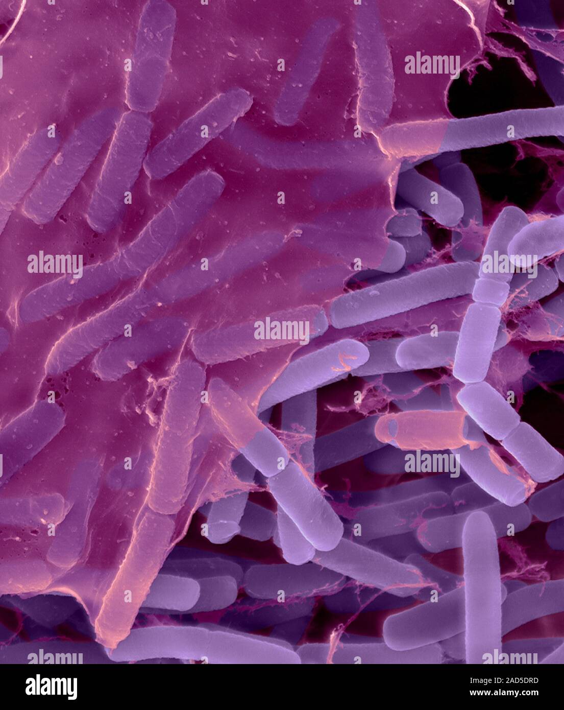 Coloured scanning electron micrograph (SEM) of Bacillus sp. forming a ...