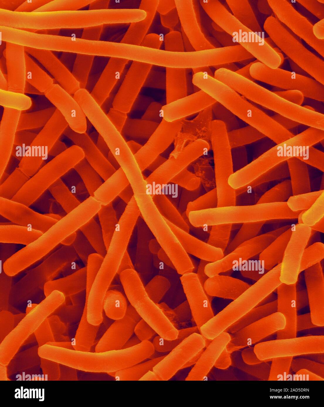 Coloured scanning electron micrograph (SEM) of Bacillus pumilus, Gram ...