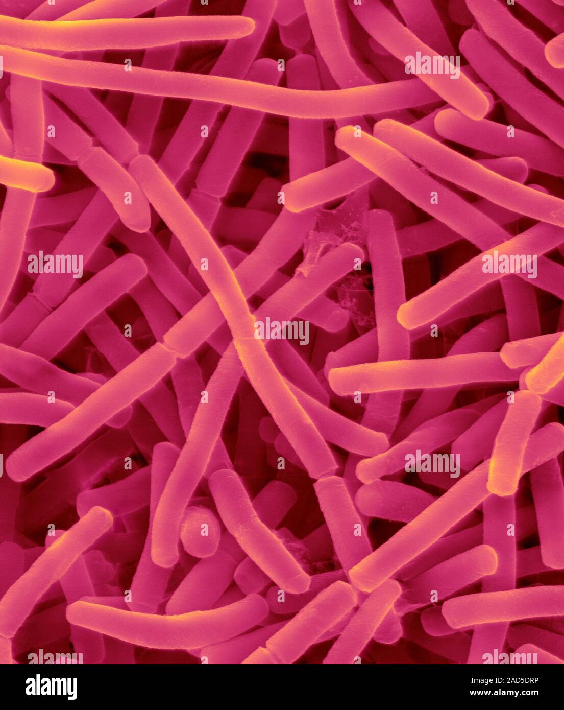 Coloured scanning electron micrograph (SEM) of Bacillus pumilus, Gram ...