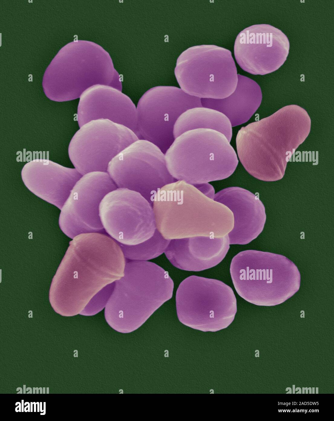 Coloured scanning electron micrograph (SEM) of Arthrobacter sp. is a ...