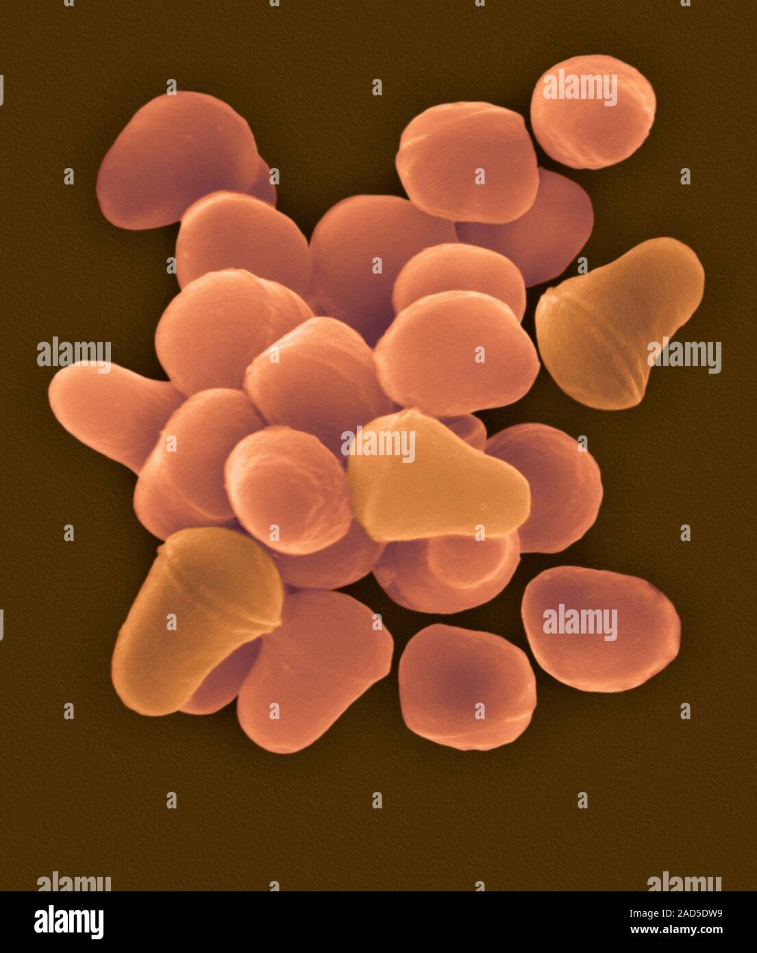 Coloured scanning electron micrograph (SEM) of Arthrobacter sp. is a ...