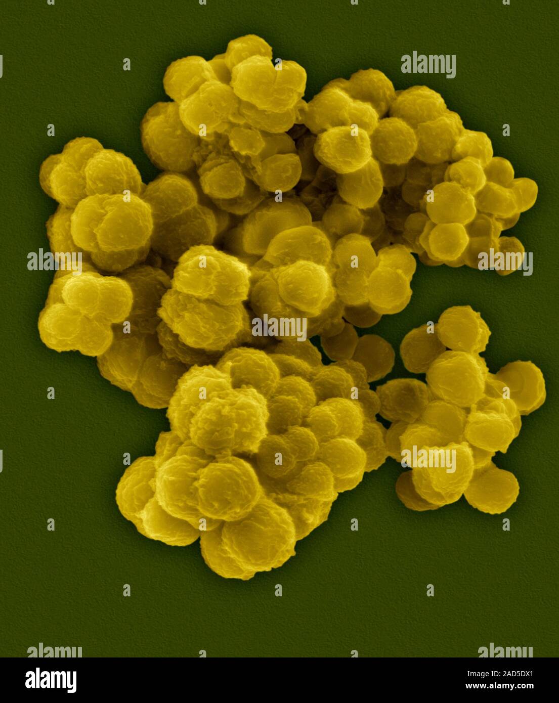 Coloured scanning electron micrograph (SEM) of Kocuria rosea, Gram ...