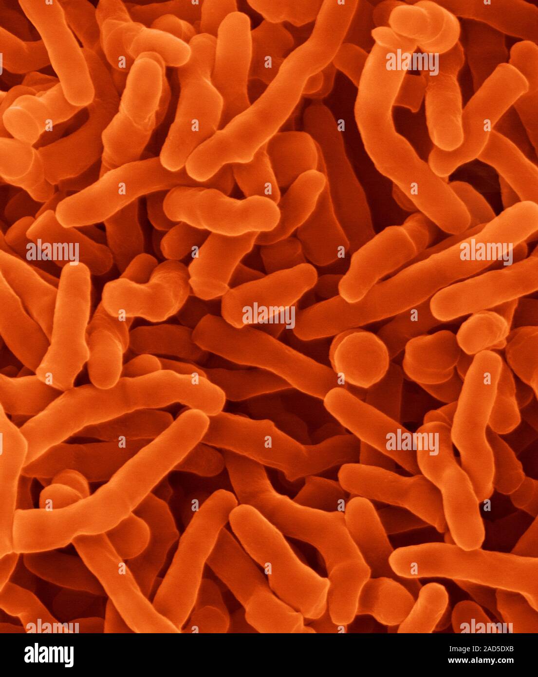 Coloured scanning electron micrograph (SEM) of Propionibacterium ...