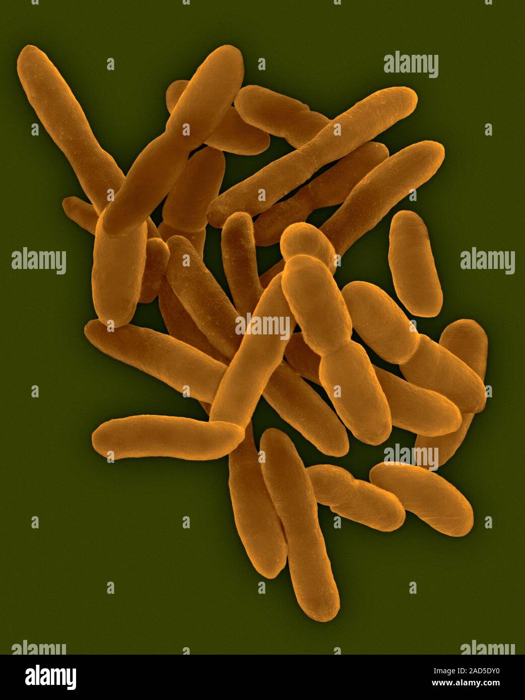 Coloured scanning electron micrograph (SEM) of Arthrobacter sp., Gram ...