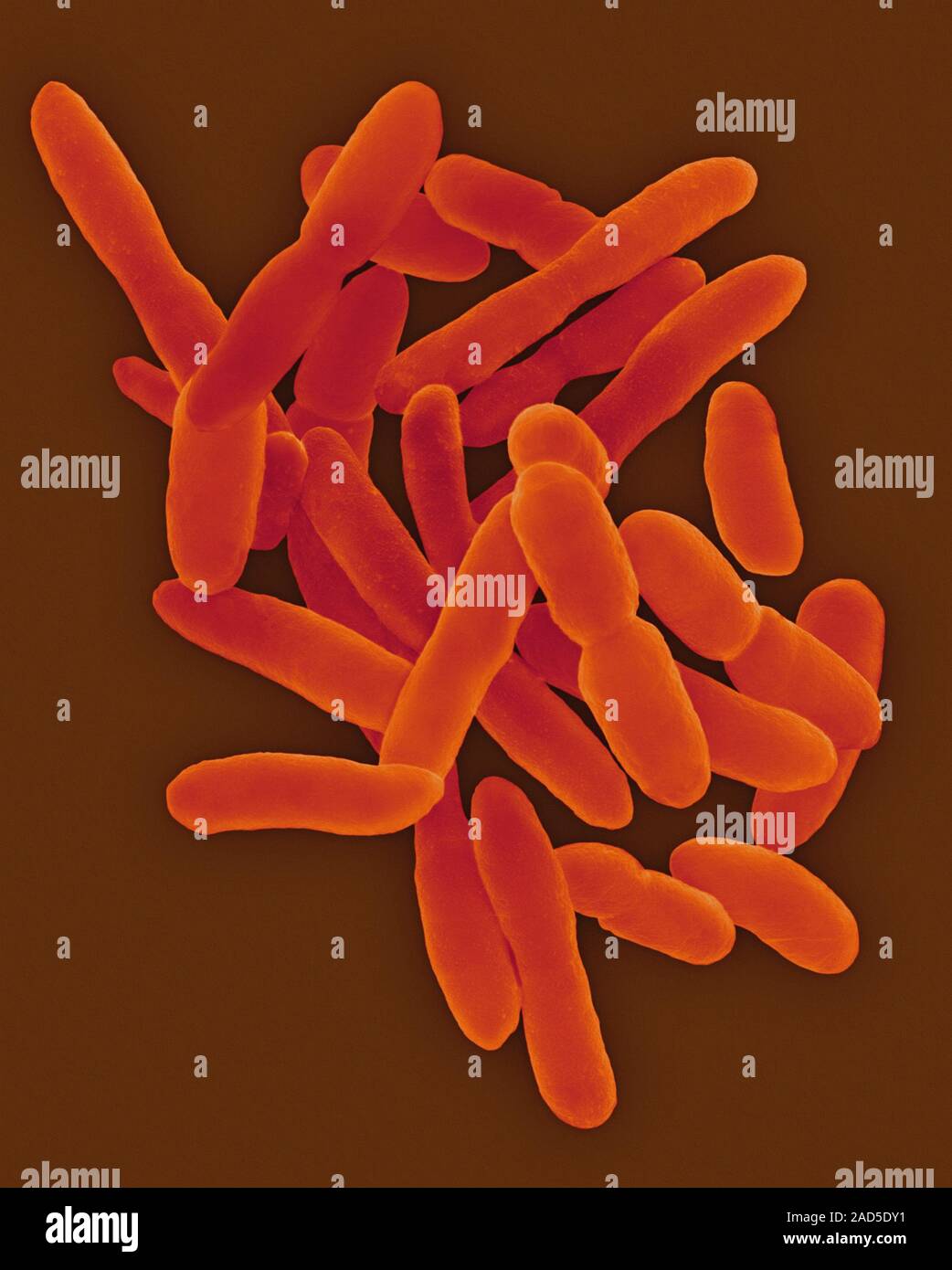 Coloured scanning electron micrograph (SEM) of Arthrobacter sp., Gram ...