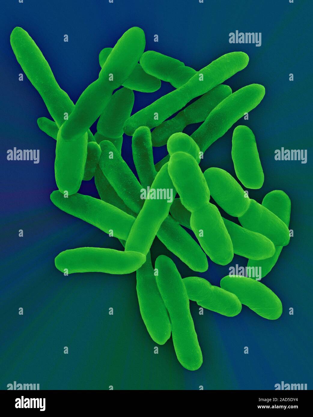 Coloured scanning electron micrograph (SEM) of Arthrobacter sp., Gram ...