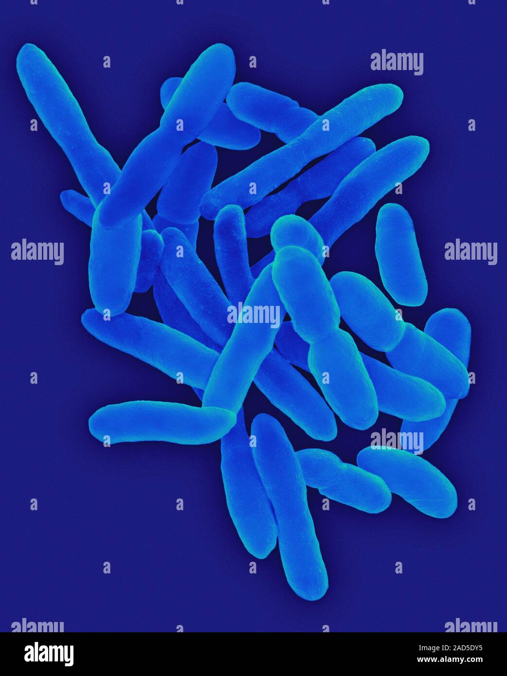 Coloured scanning electron micrograph (SEM) of Arthrobacter sp., Gram ...