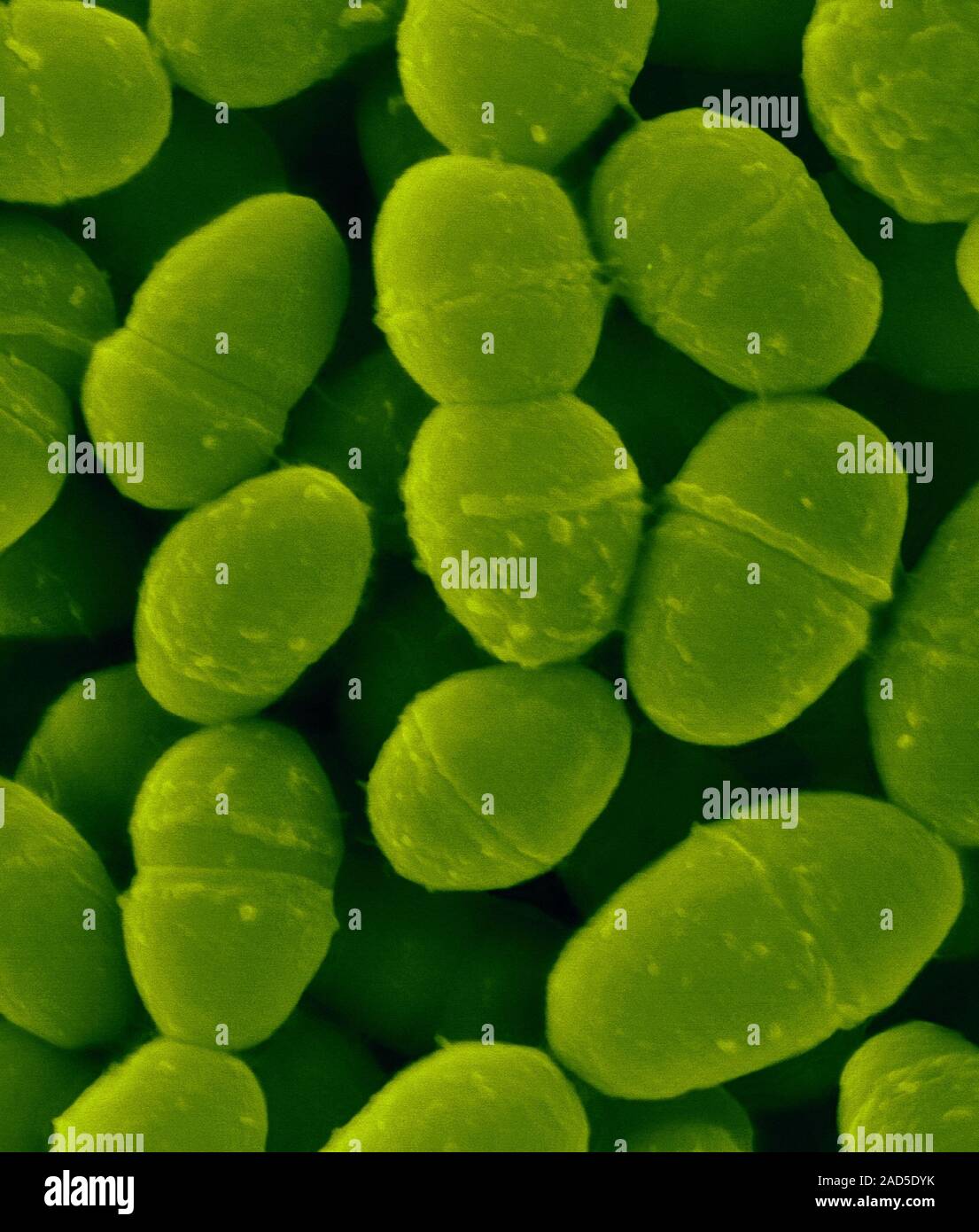 Coloured scanning electron micrograph (SEM) of Streptococcus pneumoniae ... Coloured scanning electron micrograph (SEM) of Streptococcus pneumoniae ...