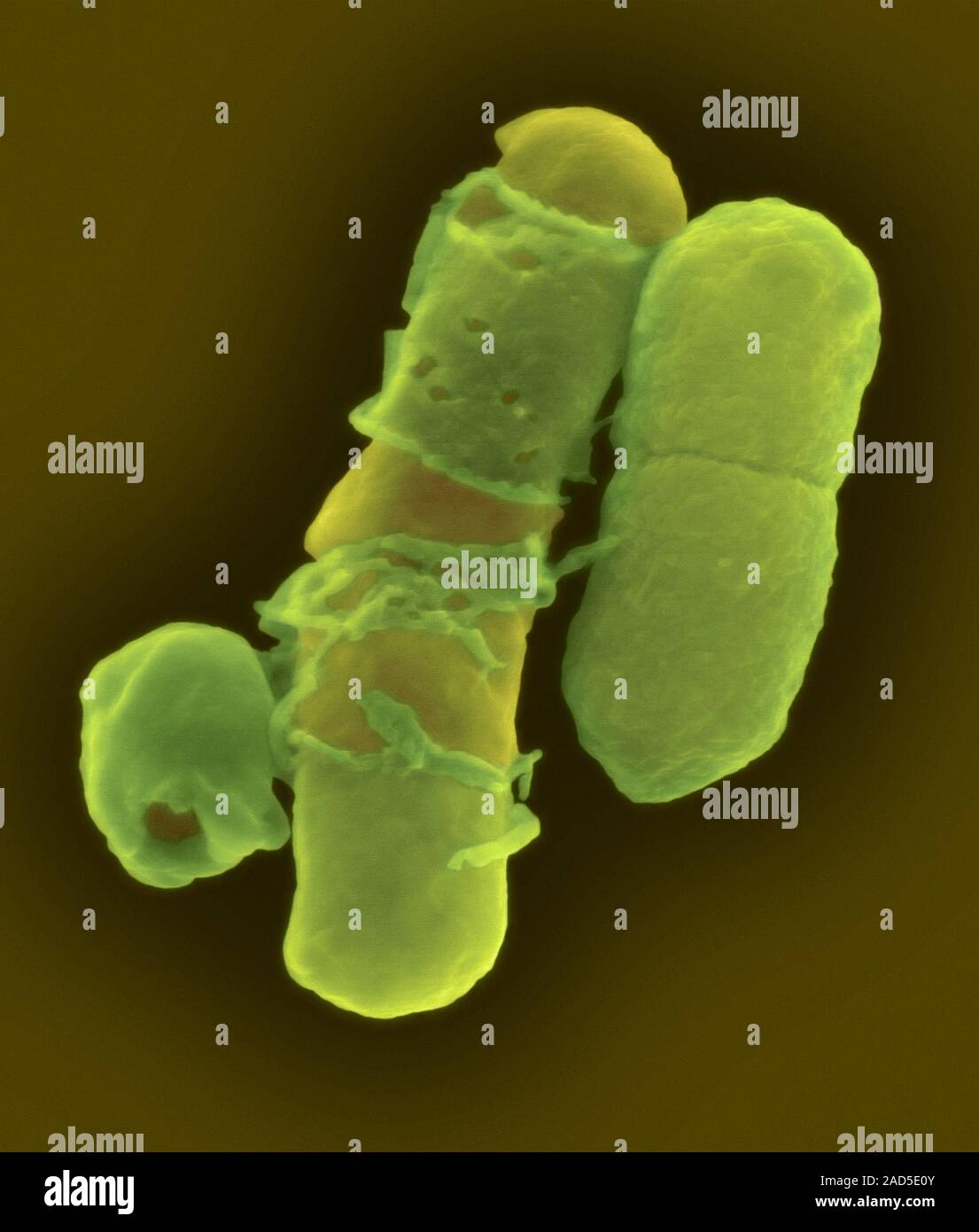 Coloured scanning electron micrograph (SEM) of Antibiotic treatment on ...