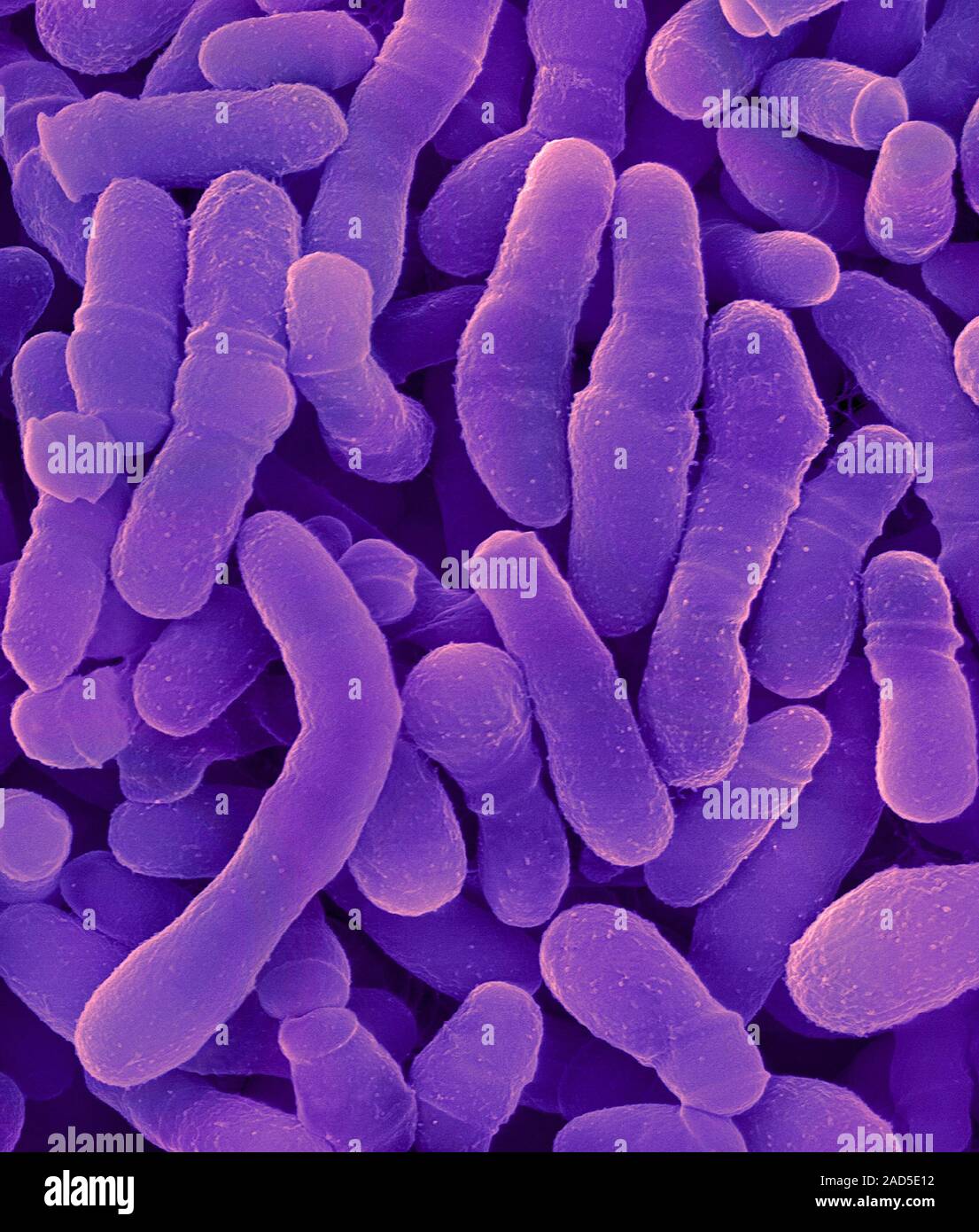 Coloured scanning electron micrograph (SEM) of Corynebacterium ...