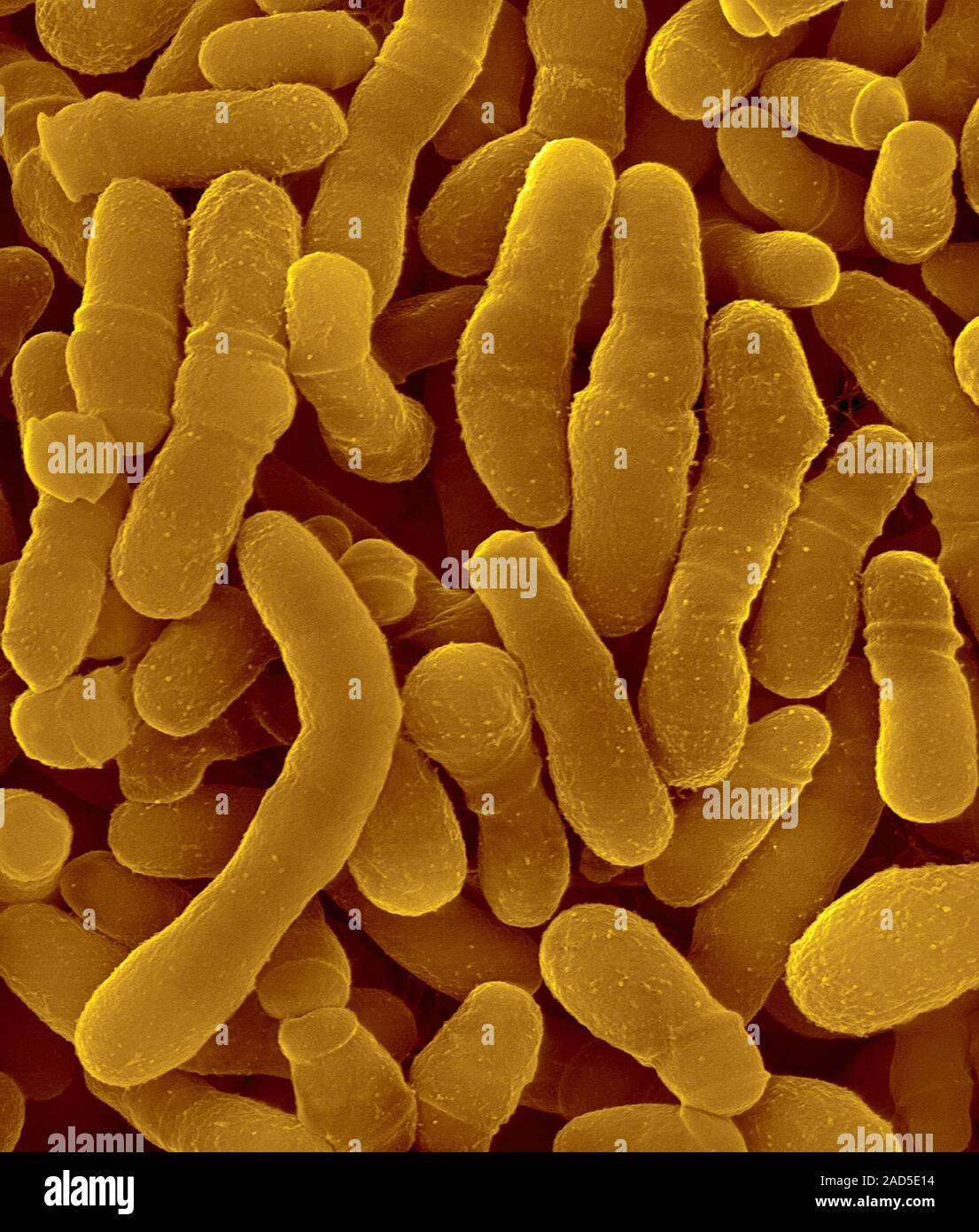 Coloured scanning electron micrograph (SEM) of Corynebacterium ...