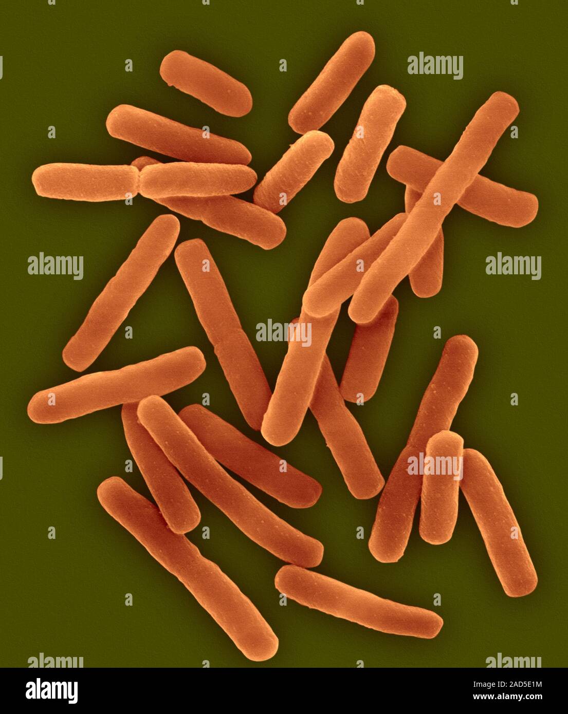 Coloured scanning electron micrograph (SEM) of E. coli (Escherichia ...