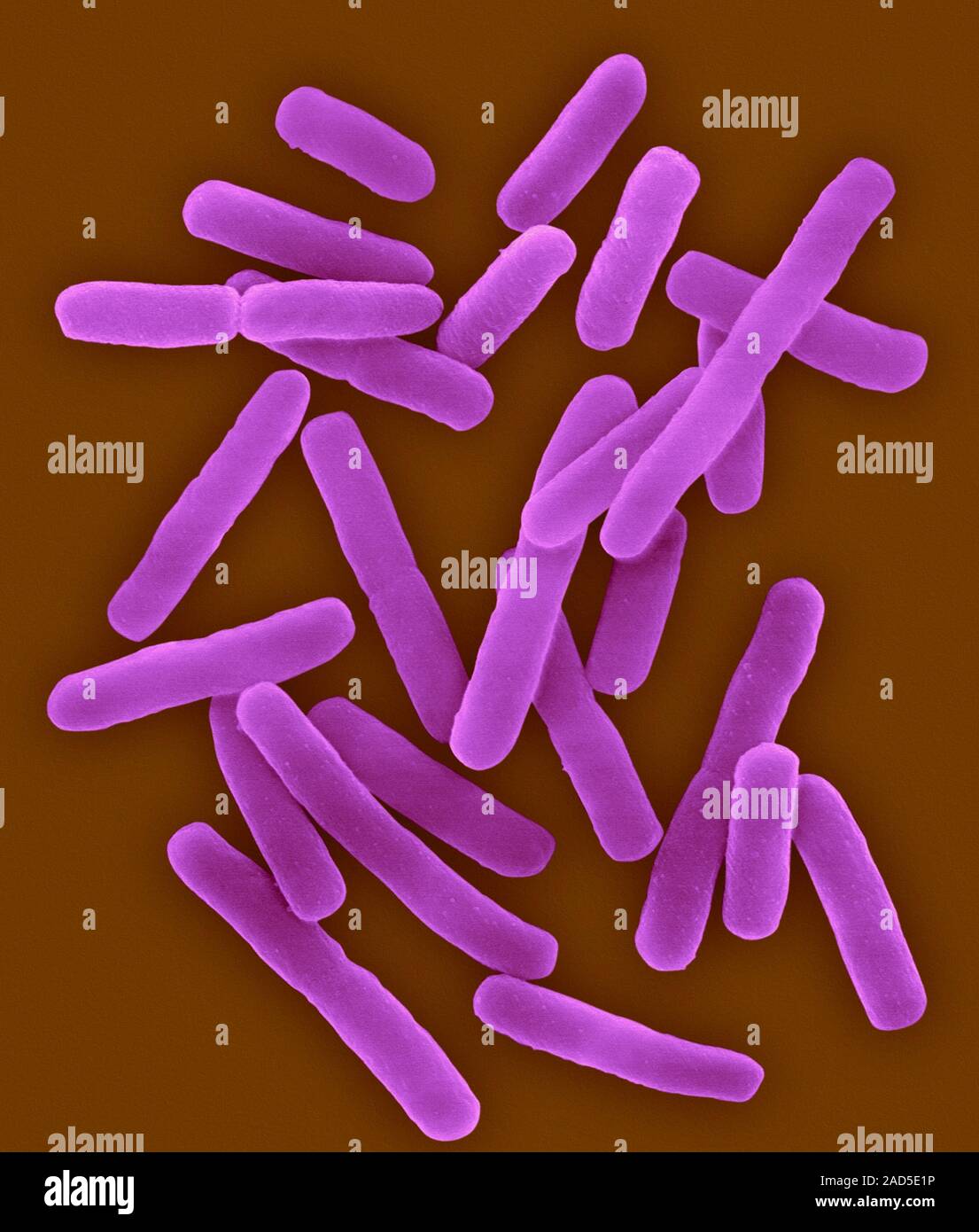 Coloured scanning electron micrograph (SEM) of E. coli (Escherichia ...