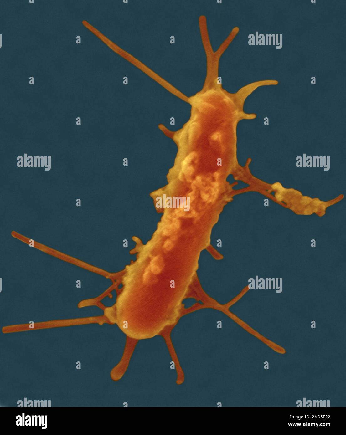 Coloured scanning electron micrograph (SEM) of Marine anaerobic ...