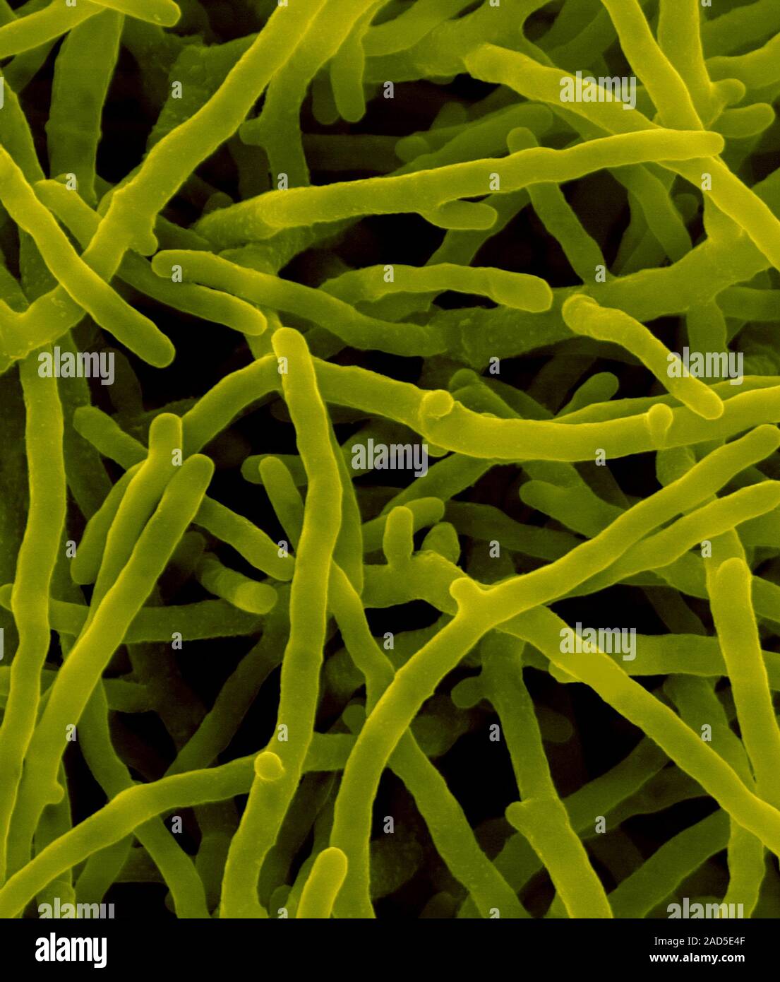 Coloured scanning electron micrograph (SEM) of Saccharopolyspora ...