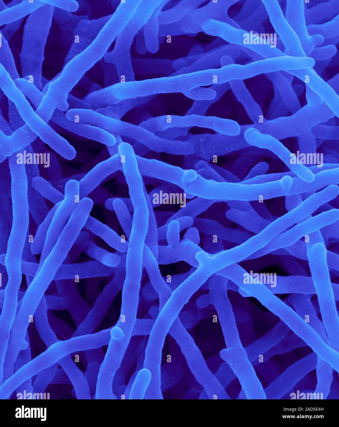 Coloured scanning electron micrograph (SEM) of Saccharopolyspora ...