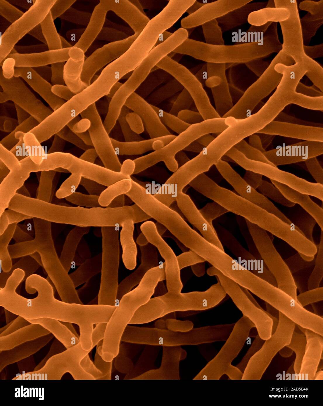 Coloured scanning electron micrograph (SEM) of Saccharopolyspora pogona ...