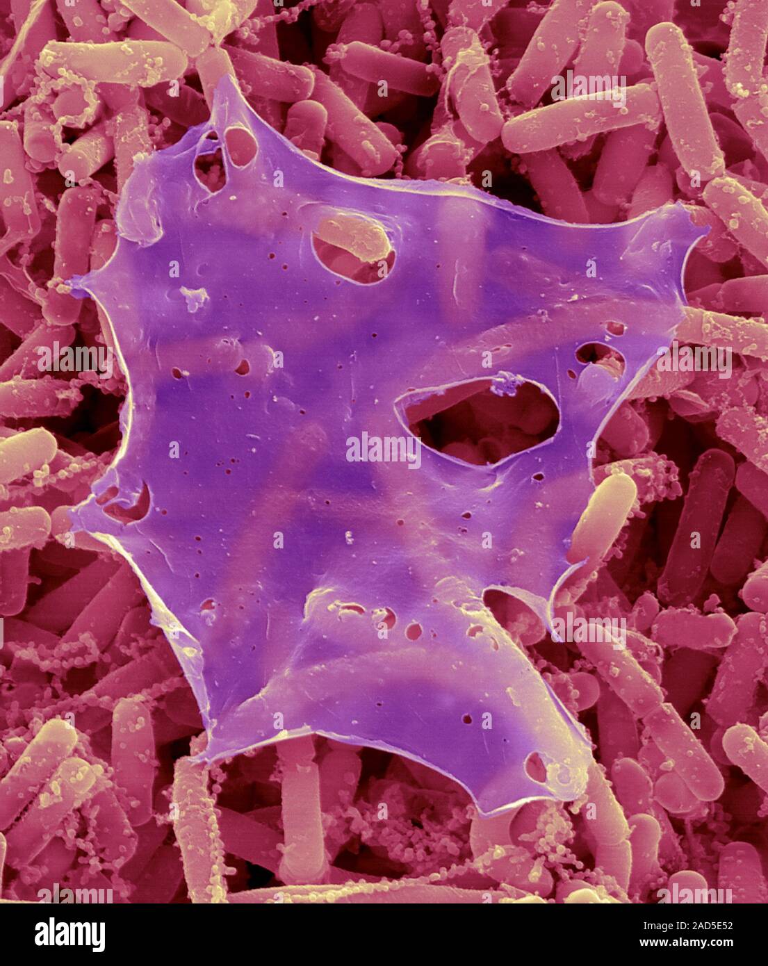 Coloured scanning electron micrograph (SEM) of Streptomyces ...