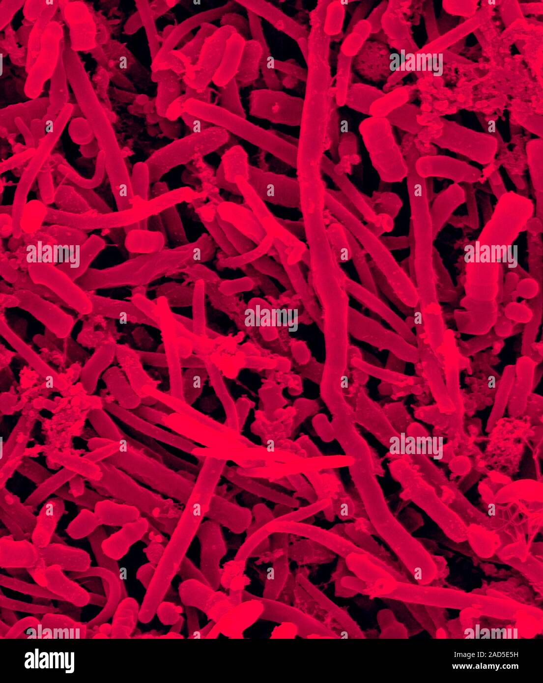 Coloured scanning electron micrograph (SEM) of Oral microbes, human ...