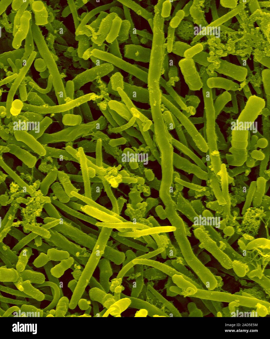 Coloured scanning electron micrograph (SEM) of Oral microbes, human ...