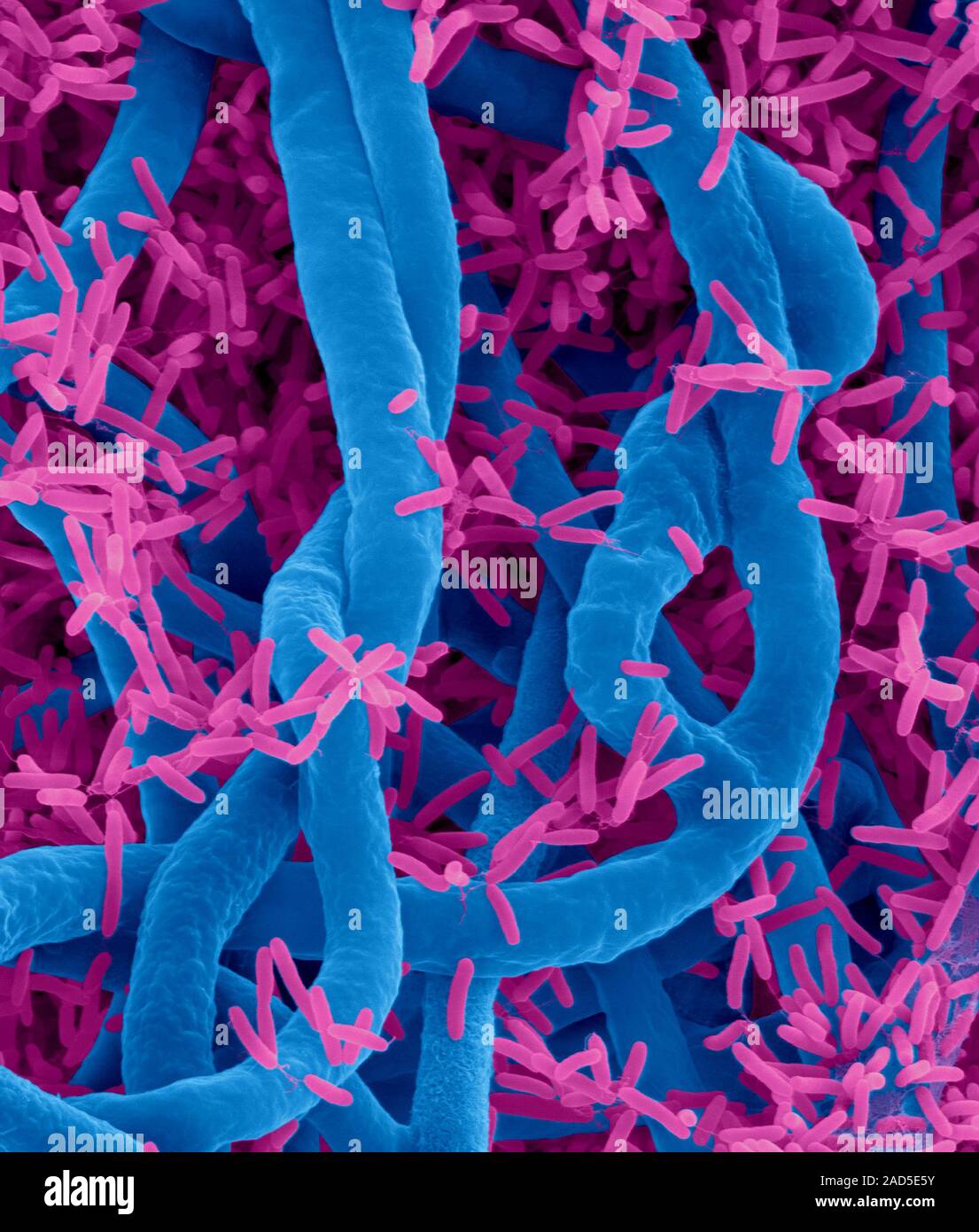 Coloured scanning electron micrograph (SEM) of Soil bacterium and soil ...