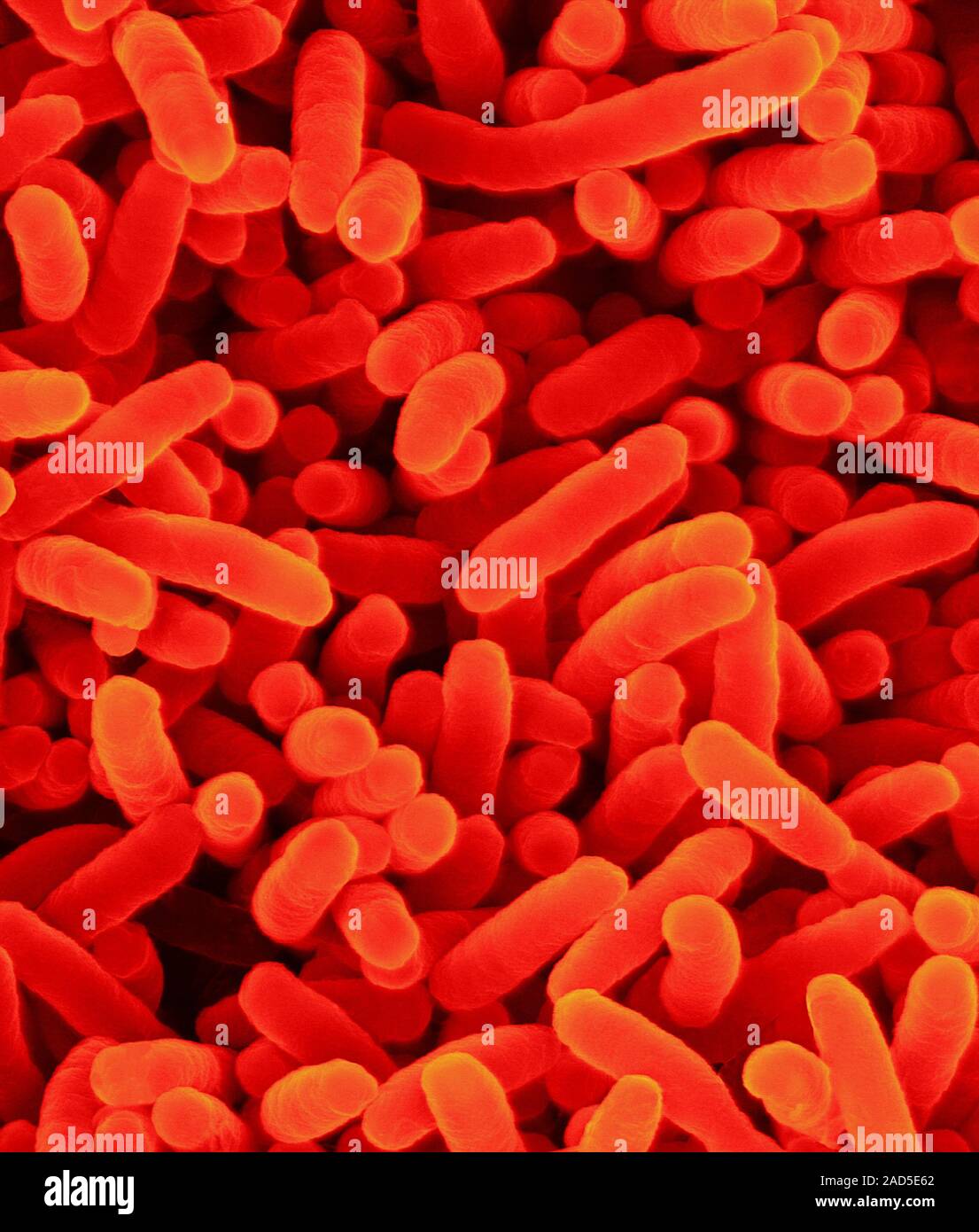 Coloured scanning electron micrograph (SEM) of Cellulose degrading ...
