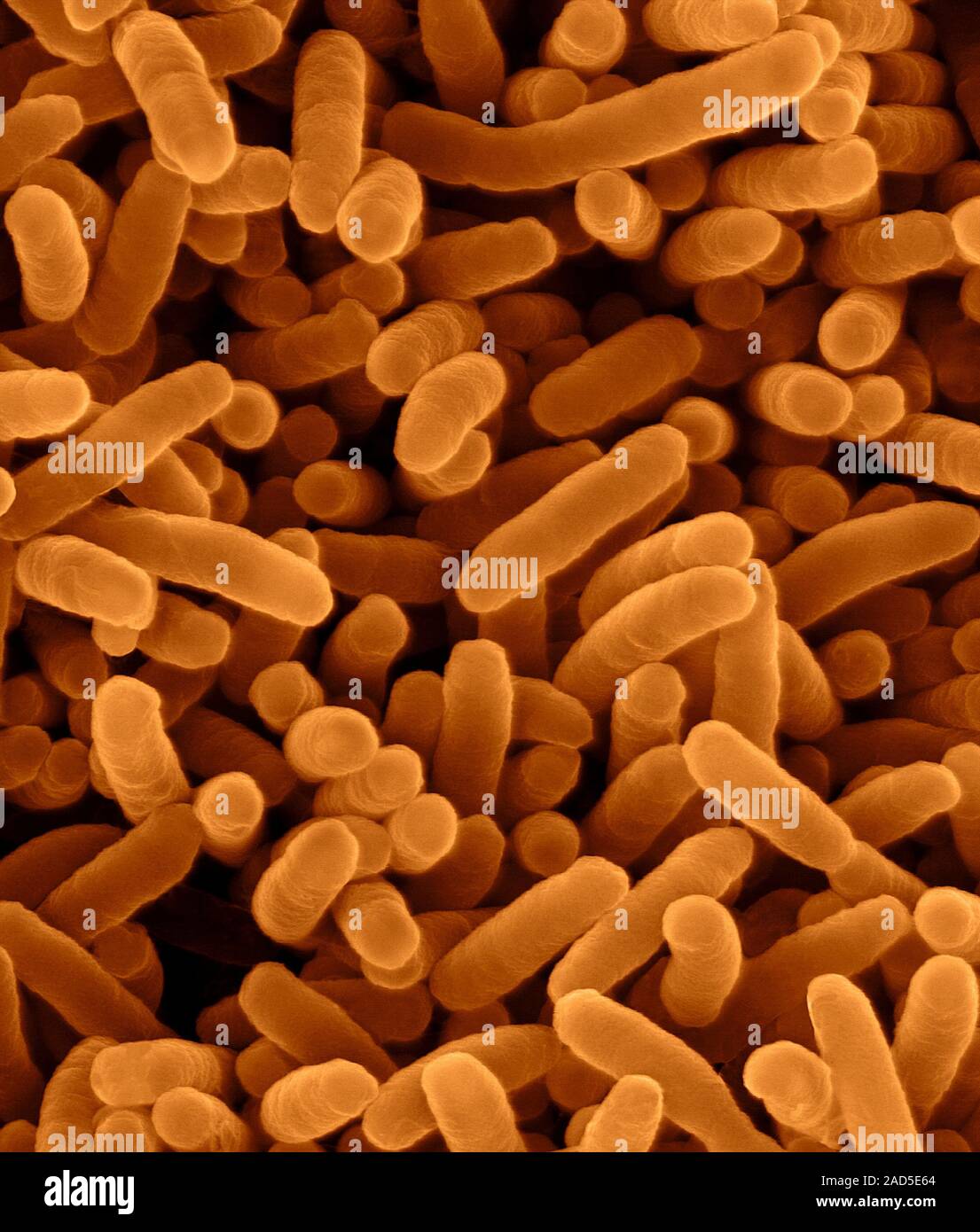 Coloured scanning electron micrograph (SEM) of Cellulose degrading ...