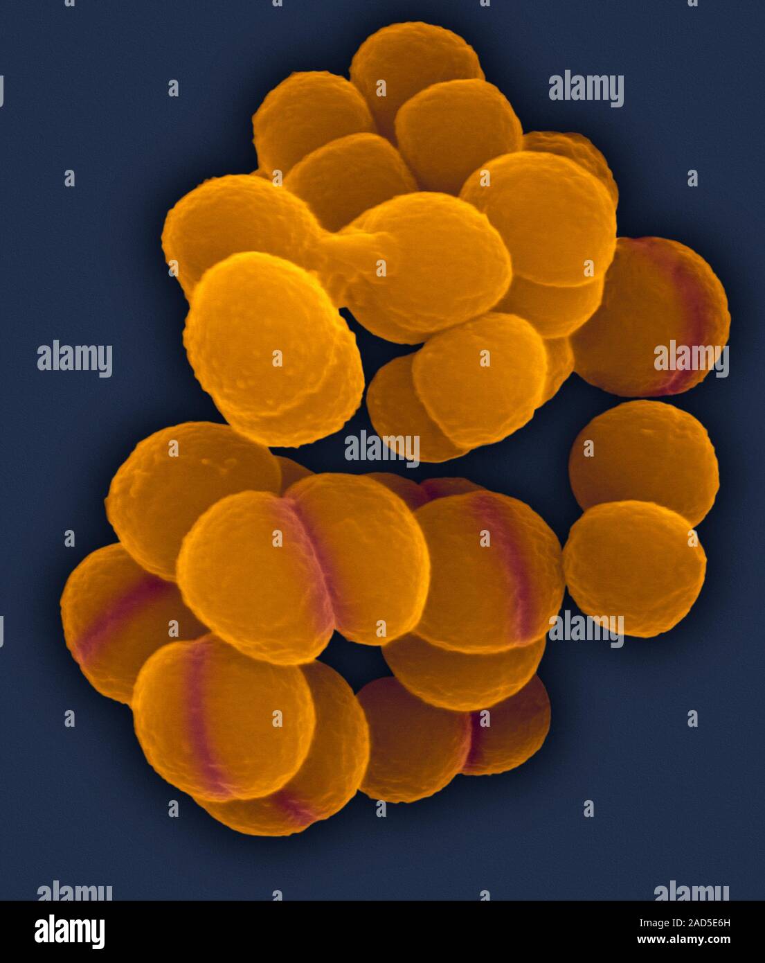 Coloured scanning electron micrograph (SEM) of Deinococcus radiophilus ...