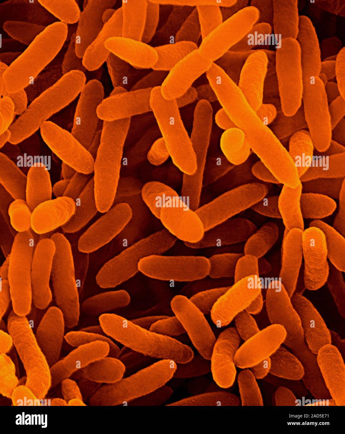 Coloured Scanning Electron Micrograph Sem Of Pseudomonas Fluorescens Gram Negative Aerobic