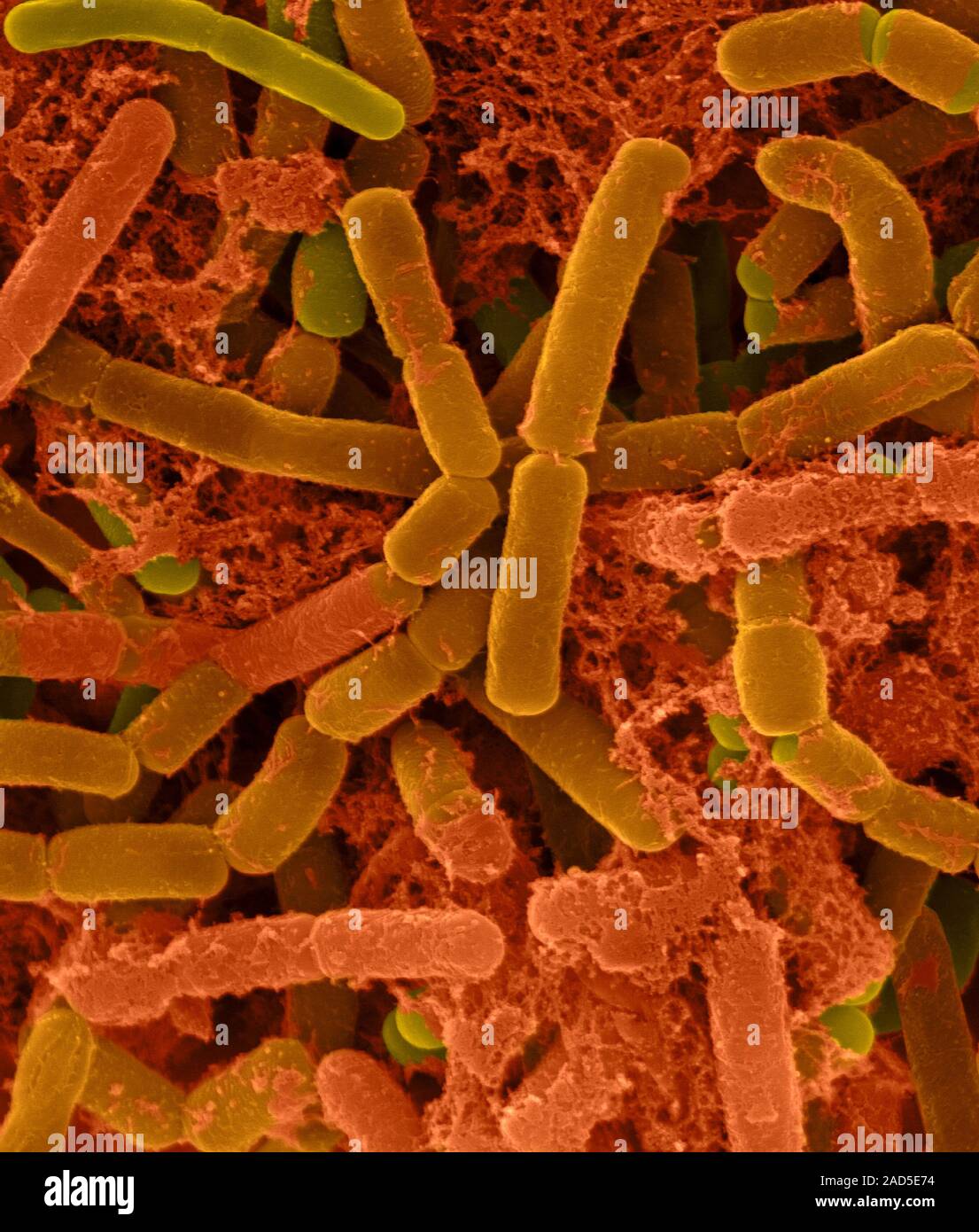 Coloured scanning electron micrograph (SEM) of Dietzia kunjamensis, rod ...