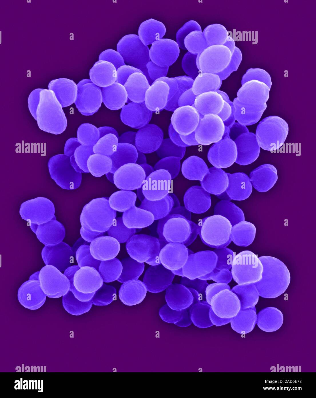 Coloured scanning electron micrograph (SEM) of Aerococcus urinaeequi ...