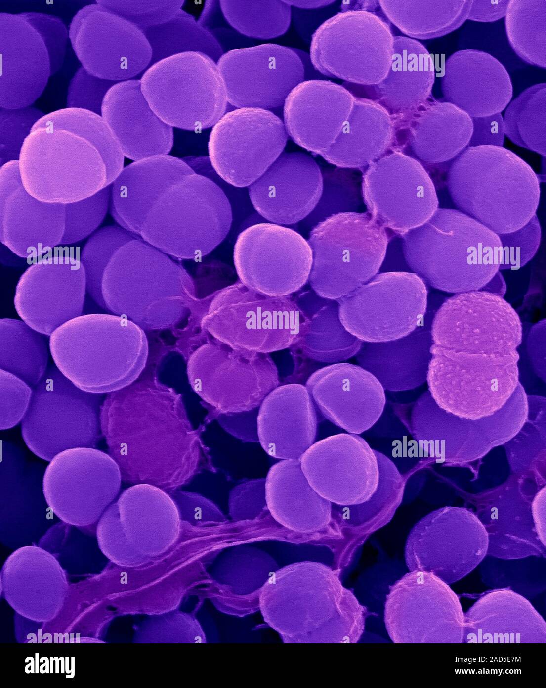 Coloured scanning electron micrograph (SEM) of Staphylococcus ...