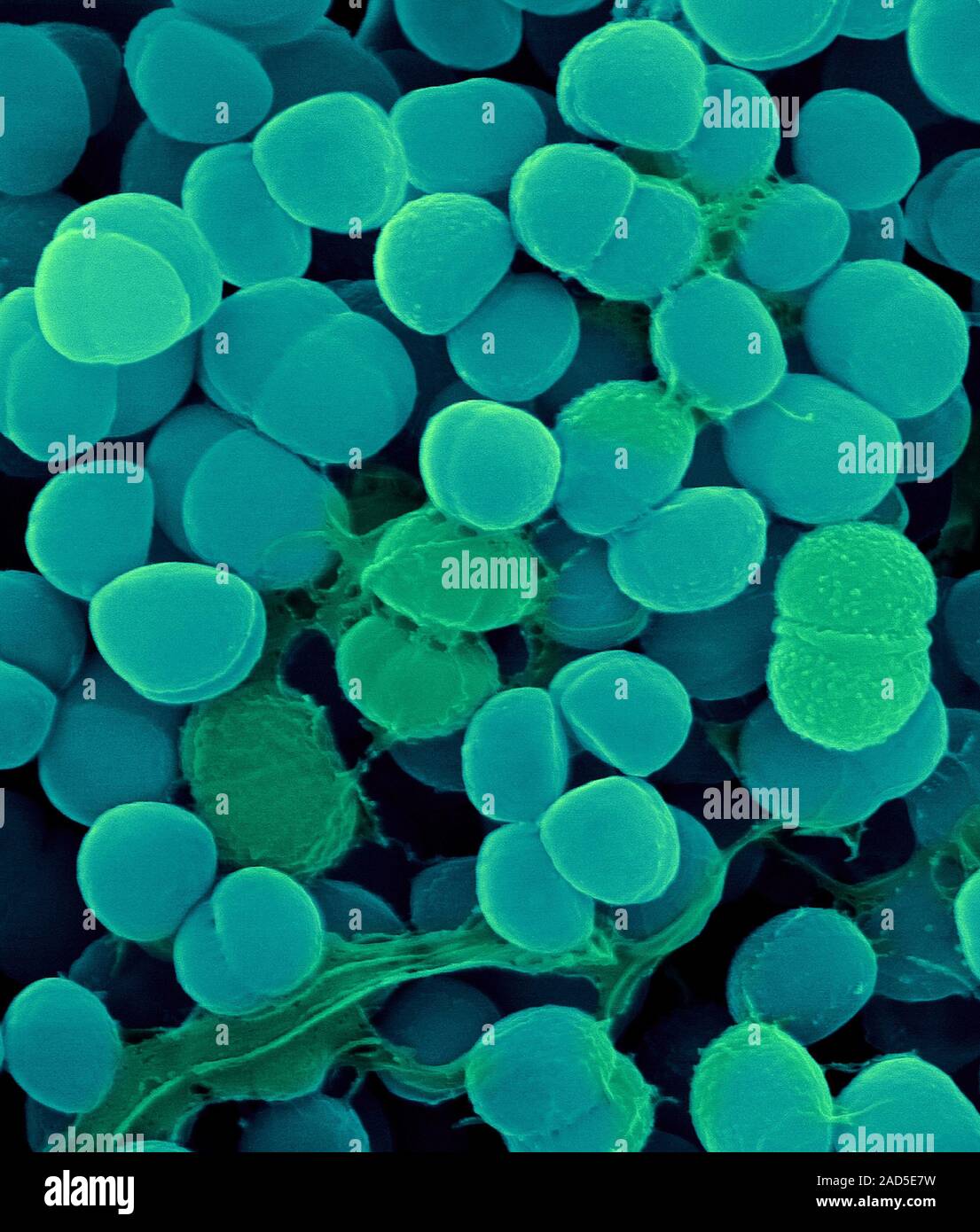 Coloured scanning electron micrograph (SEM) of Staphylococcus ...