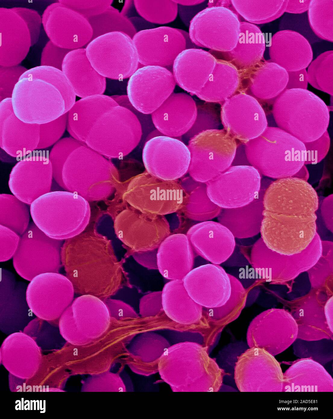 Coloured scanning electron micrograph (SEM) of Staphylococcus ...
