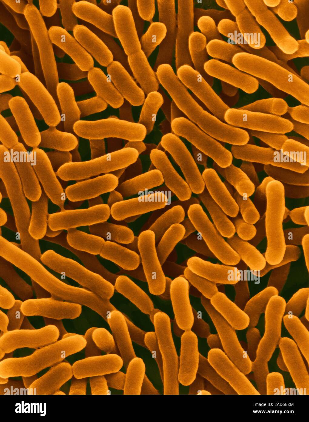 Coloured scanning electron micrograph (SEM) of Salmonella enterica ...