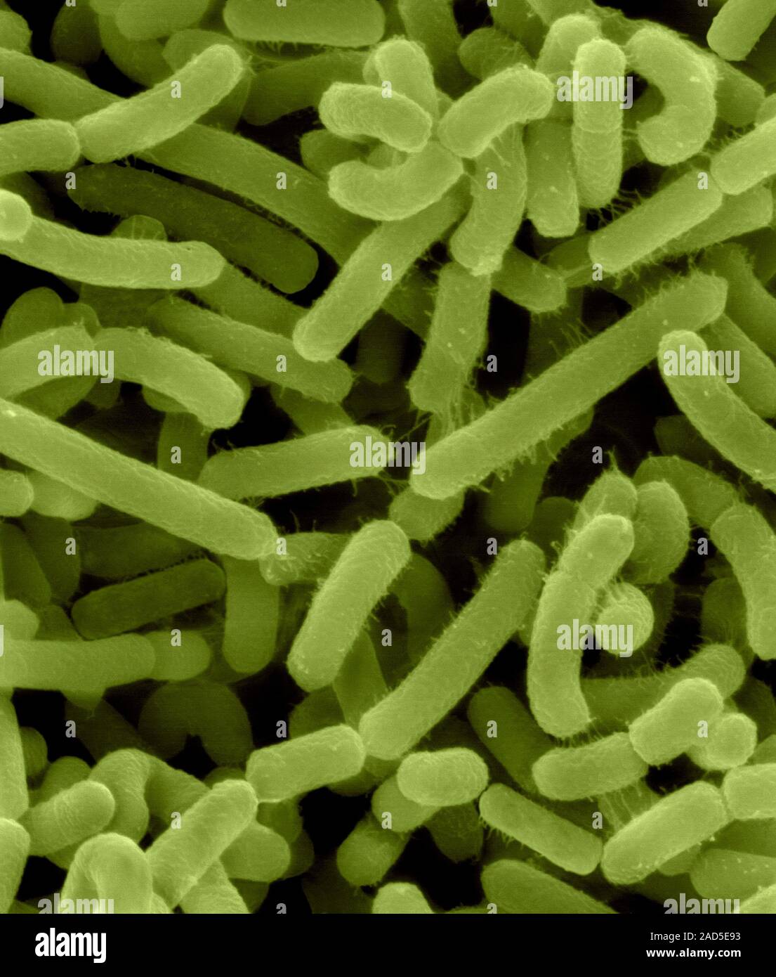 Coloured scanning electron micrograph (SEM) of Agrobacterium ...