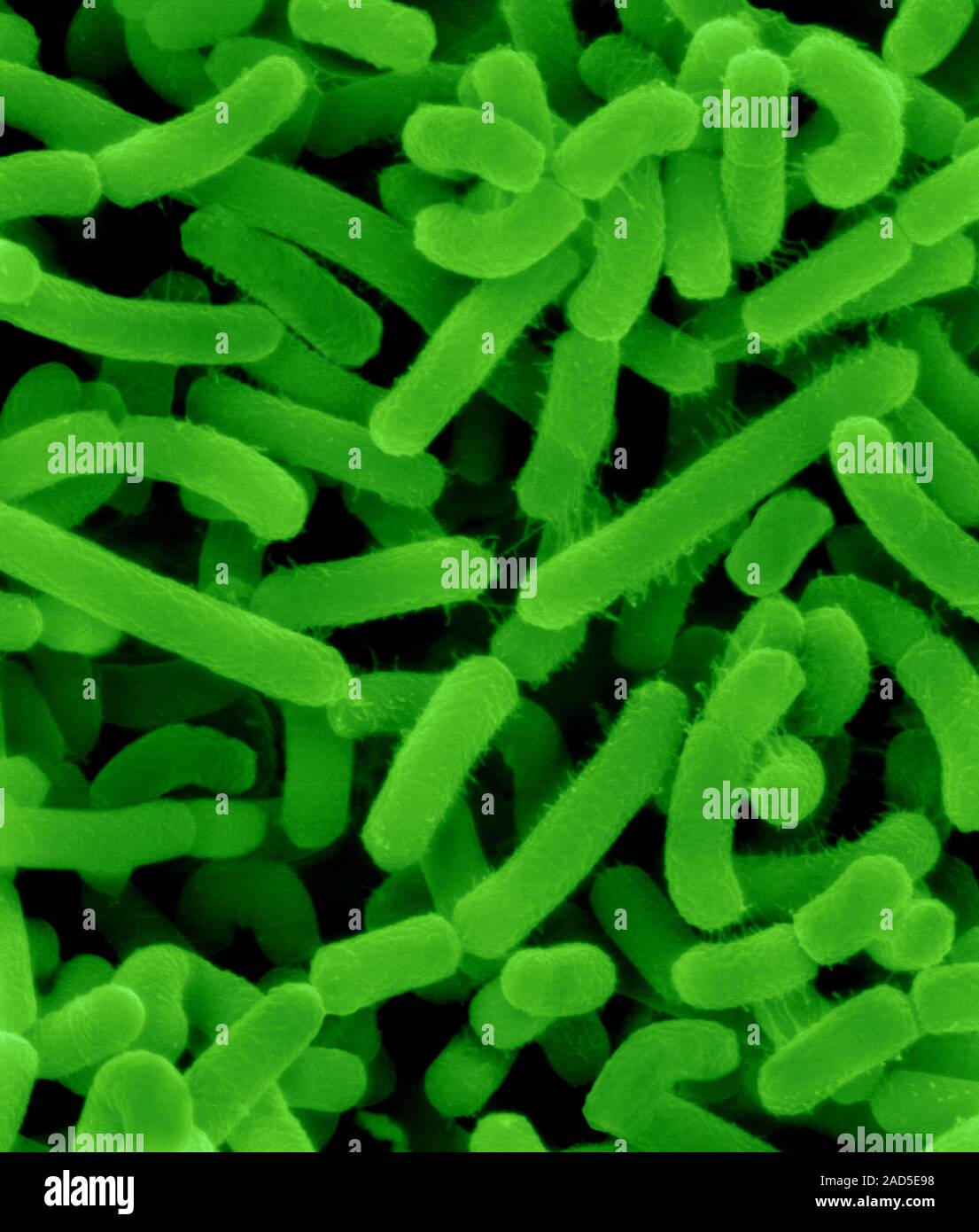 Coloured scanning electron micrograph (SEM) of Agrobacterium ...
