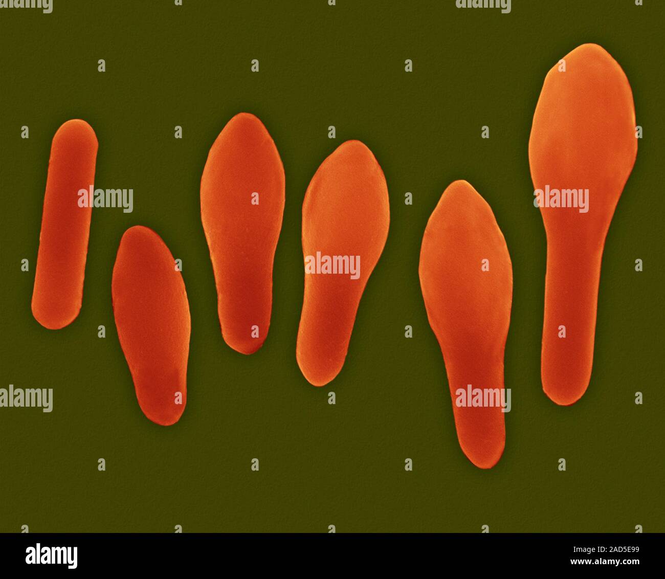 Coloured scanning electron micrograph (SEM) of Clostridium spore ...