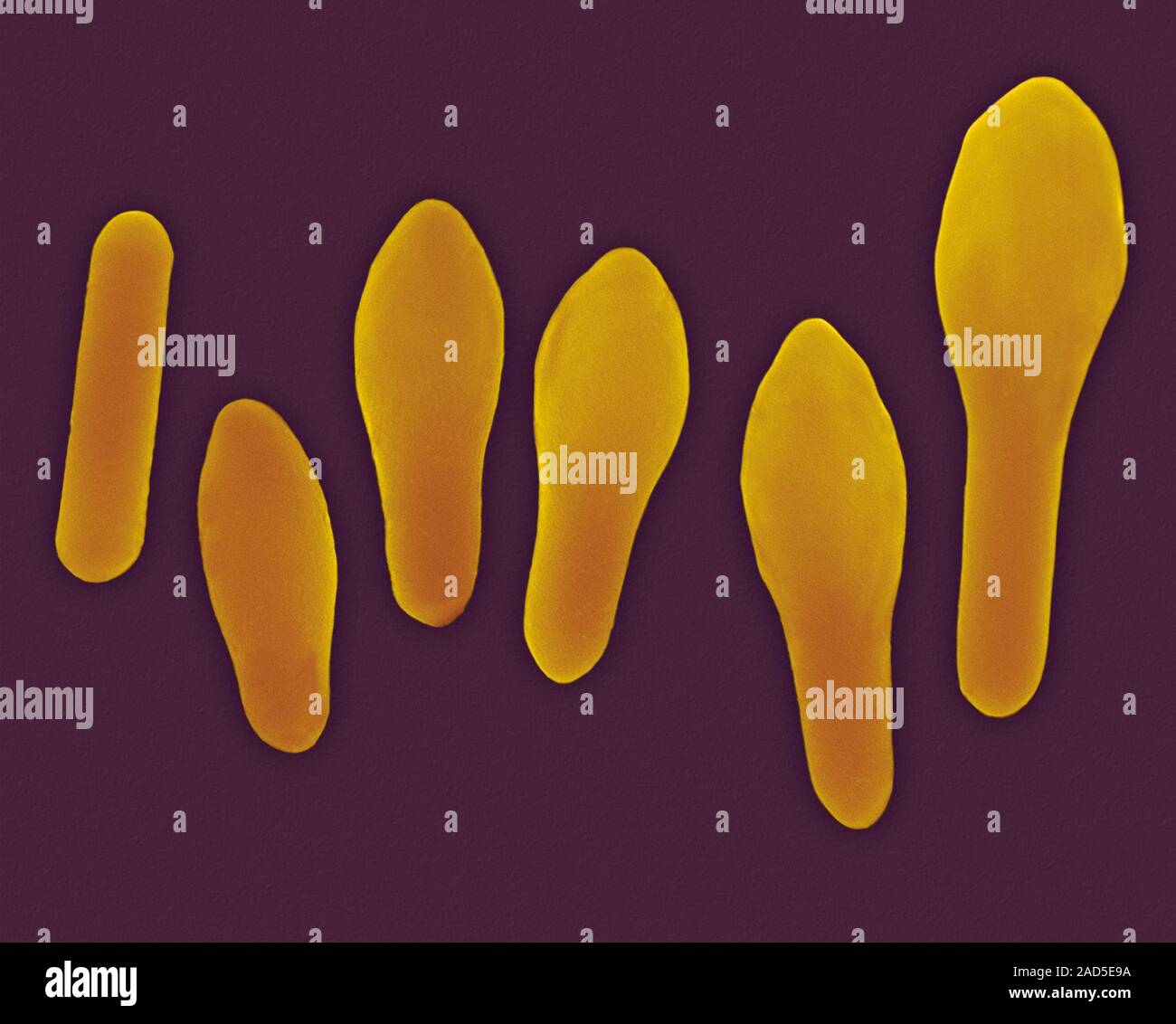 Coloured scanning electron micrograph (SEM) of Clostridium spore ...