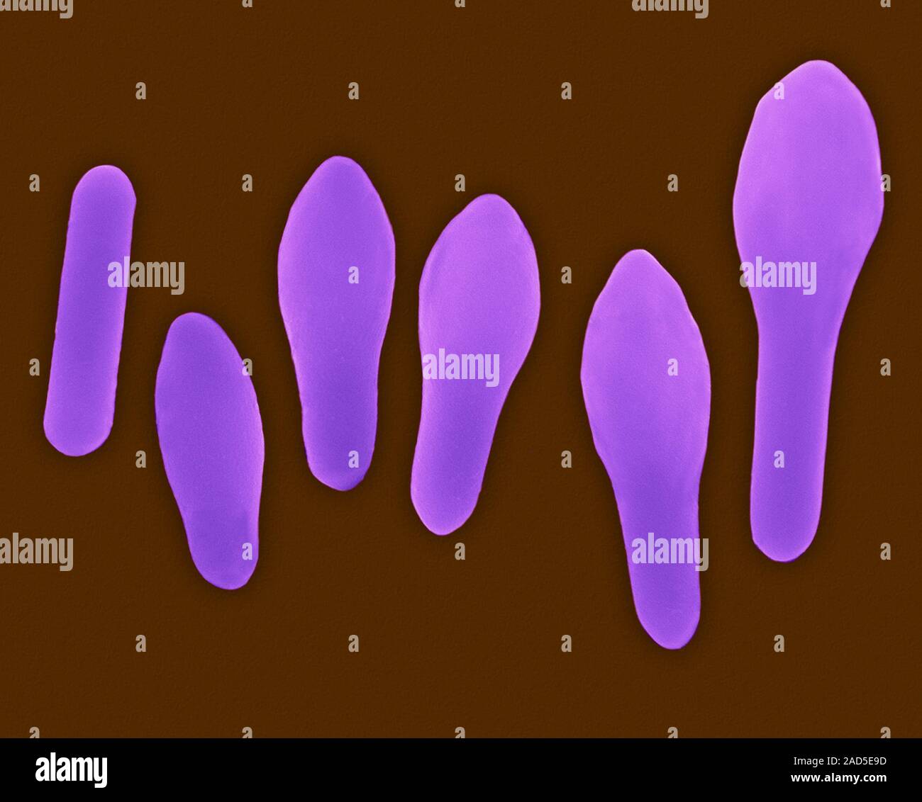 Coloured scanning electron micrograph (SEM) of Clostridium spore ...