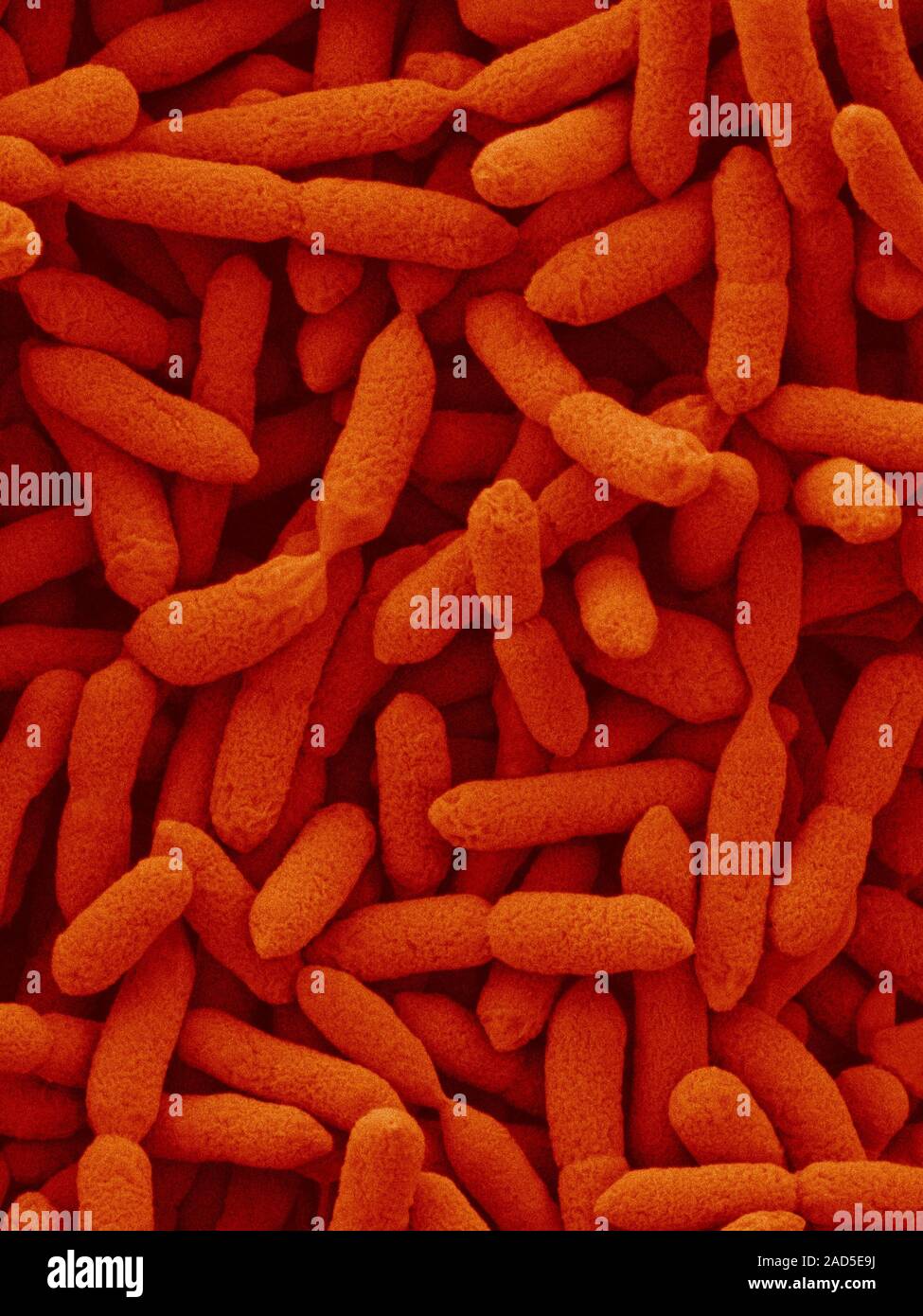 Coloured scanning electron micrograph (SEM) of Oceanimonas baumannii ...