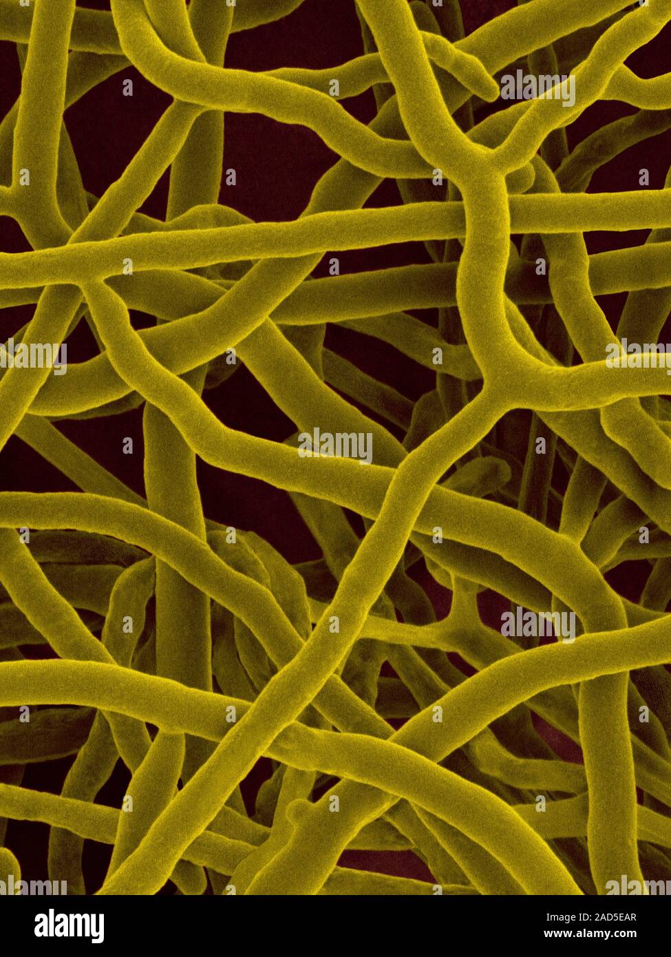 Coloured scanning electron micrograph (SEM) of Streptomyces ...