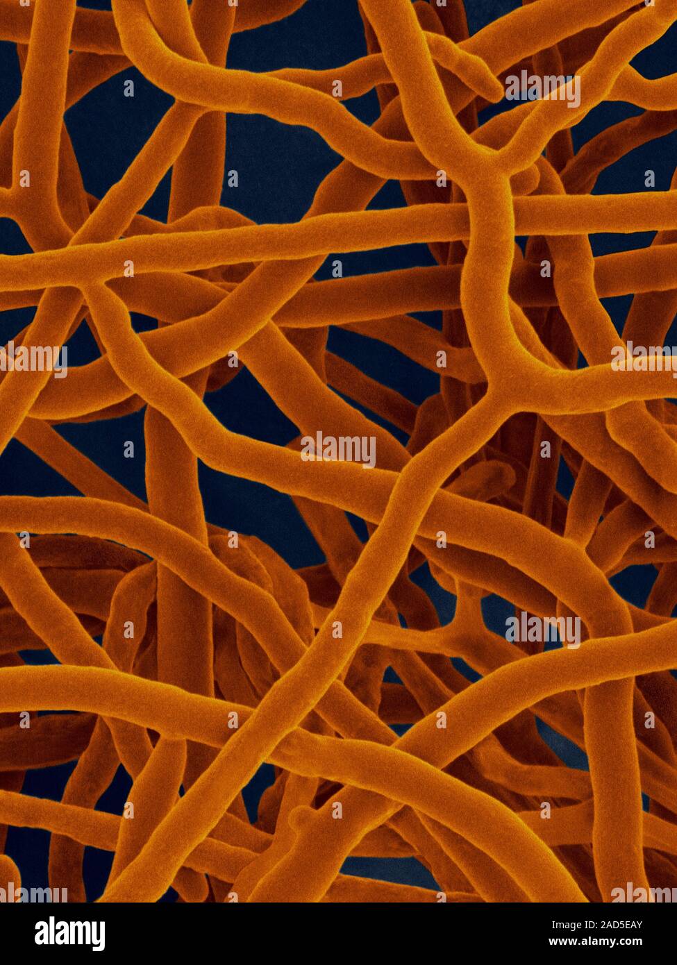 Coloured scanning electron micrograph (SEM) of Streptomyces ...