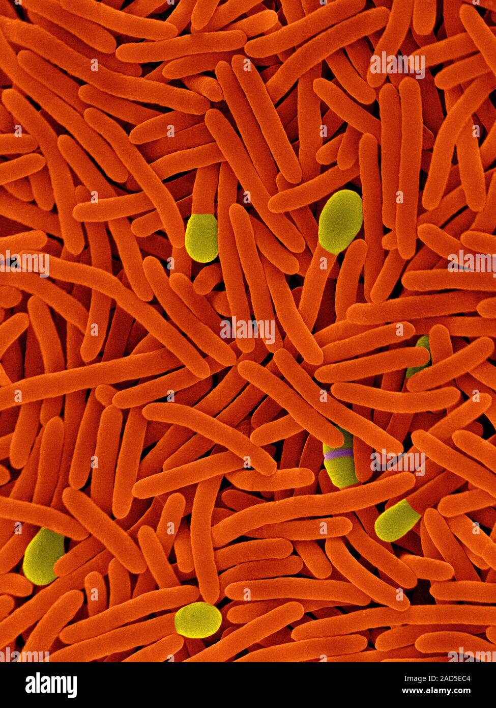 Coloured scanning electron micrograph (SEM) of Clostridium ...