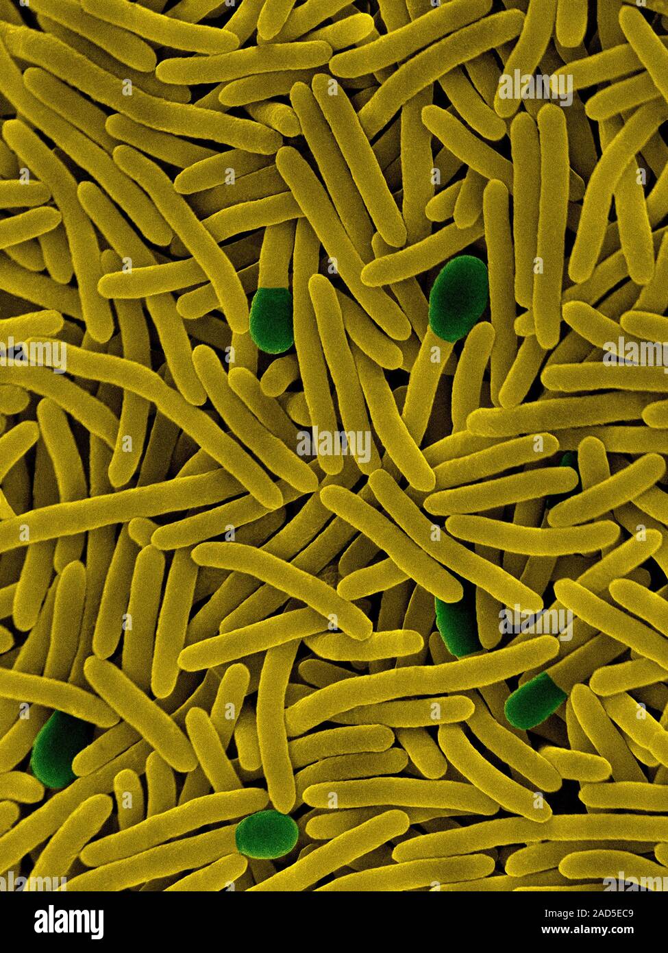 Coloured scanning electron micrograph (SEM) of Clostridium ...